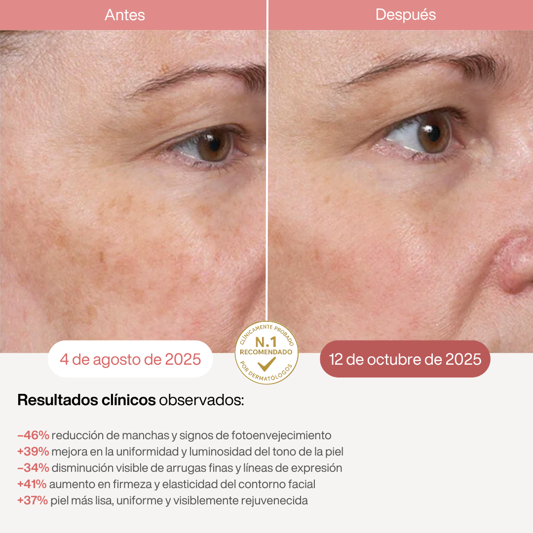 Eternas Máscara LED Infrarroja Profesional - 850nm